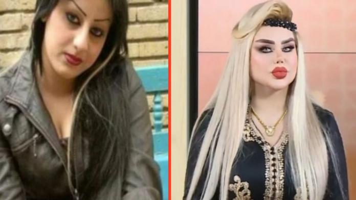 Tagħmel 43 proċedura kożmetika biex tiġi tixbah lil Barbie - Newsbook