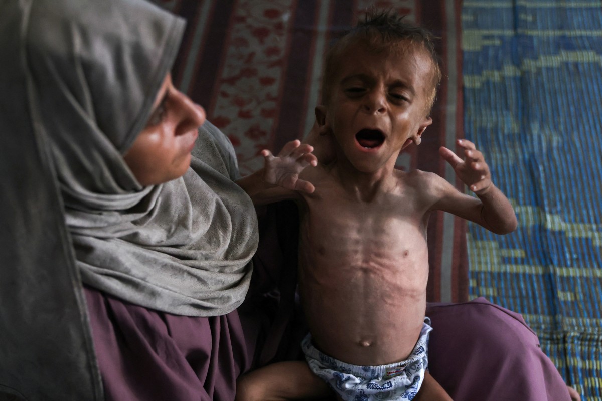 Infant deaths from starvation rise in Gaza as humanitarian crisis deepens